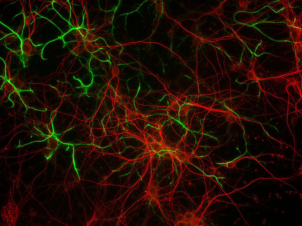 Mouse C57 Cortex Neurons Cryo, 4 mil | M-CX-300 | East Port Praha